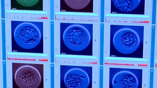 Embryoscope Perth | Advanced Fertility Technology