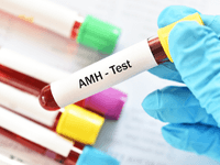 Anti Mullerian Hormone (AMH) Blood Test for Ovarian Reserve